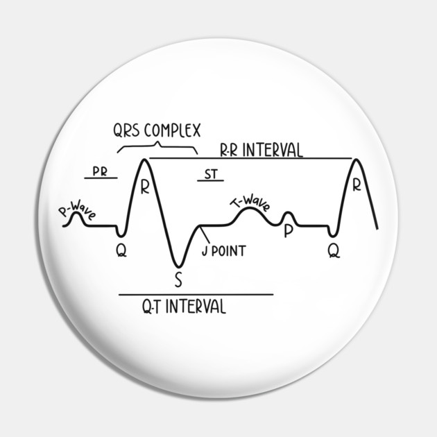 normal electrocardiogram labeled