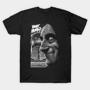 marty feldman abnormal